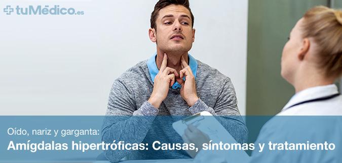 Amígdalas hipertróficas: Causas, síntomas y tratamiento