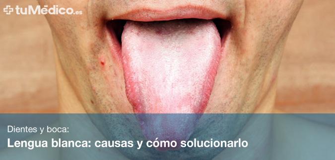 Manchas Blancas En La Lengua: Causas Y Cómo Tratarlas – EGXMZ
