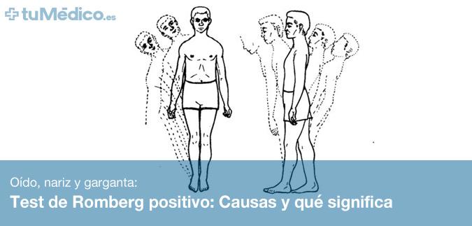 Test de Romberg positivo: Causas y qué significa