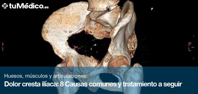 Dolor cresta ilíaca: 8 Causas comunes y tratamiento a seguir